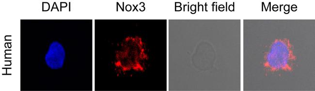 NOX3 Antibody (PA5-38036) in IF | Thermo Fisher Scientific - CN